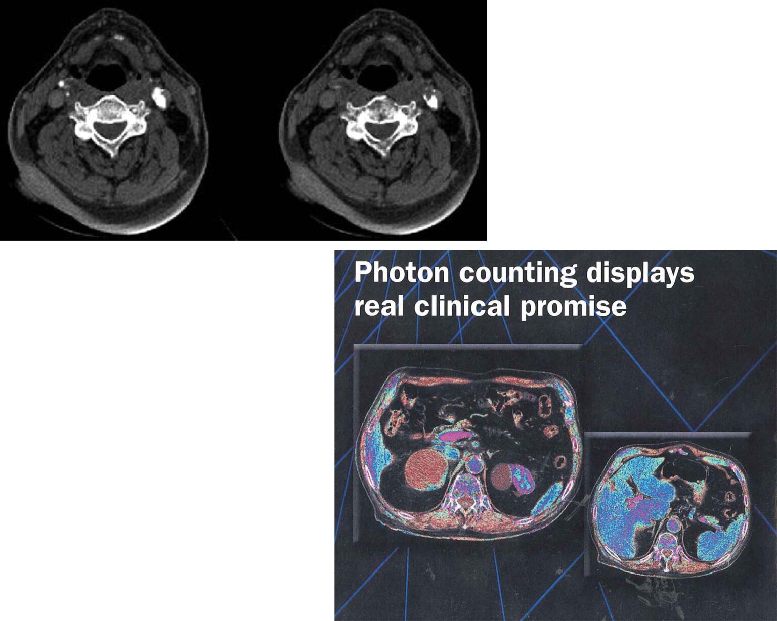 CT Archives - AAPM Virtual Museum